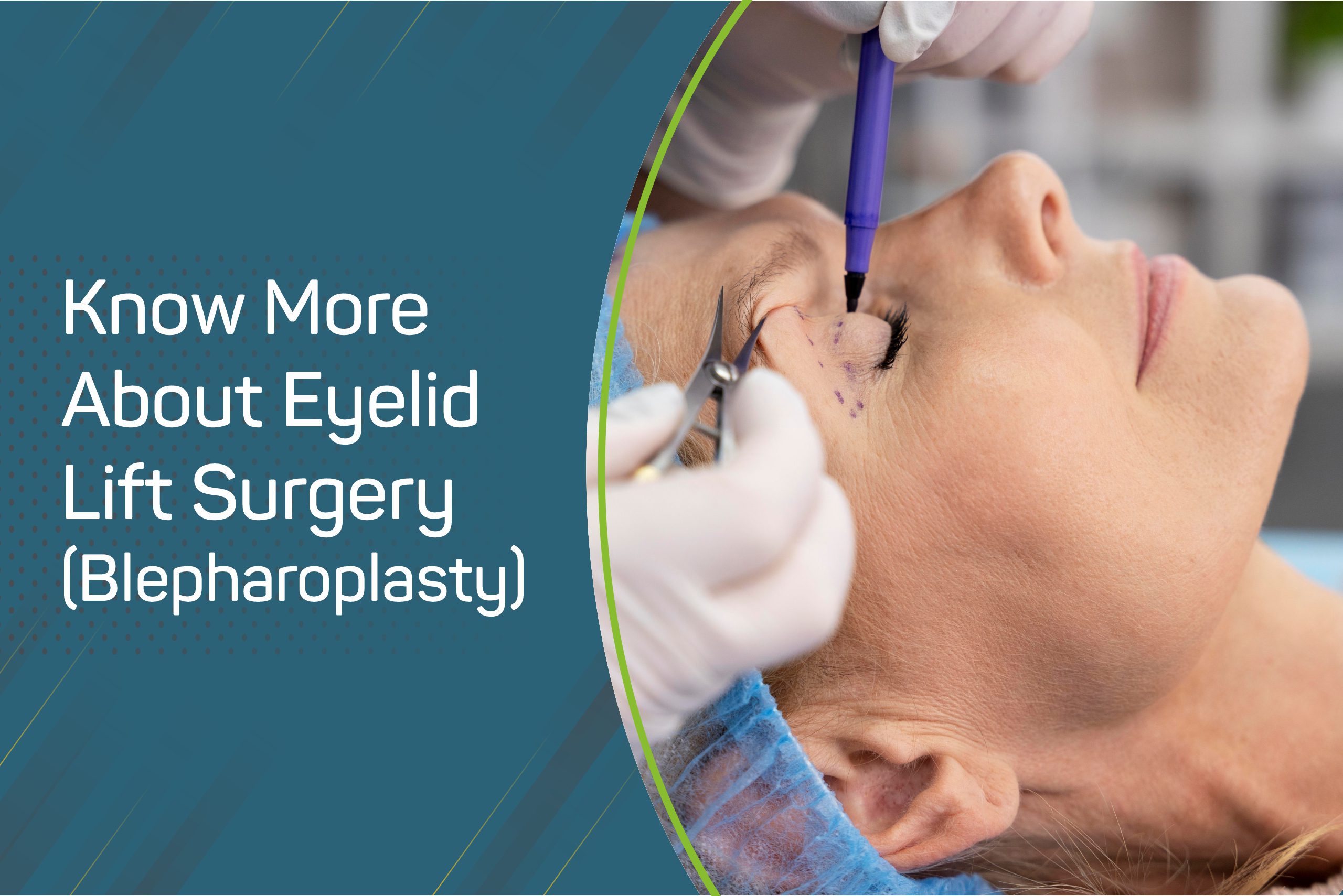 Eyelid Lift Surgery | Expert Care at Sattva Eye Care